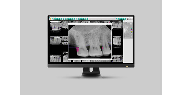 DEXIS Introduces DEXIS 10 Imaging Suite Software featuring the ...