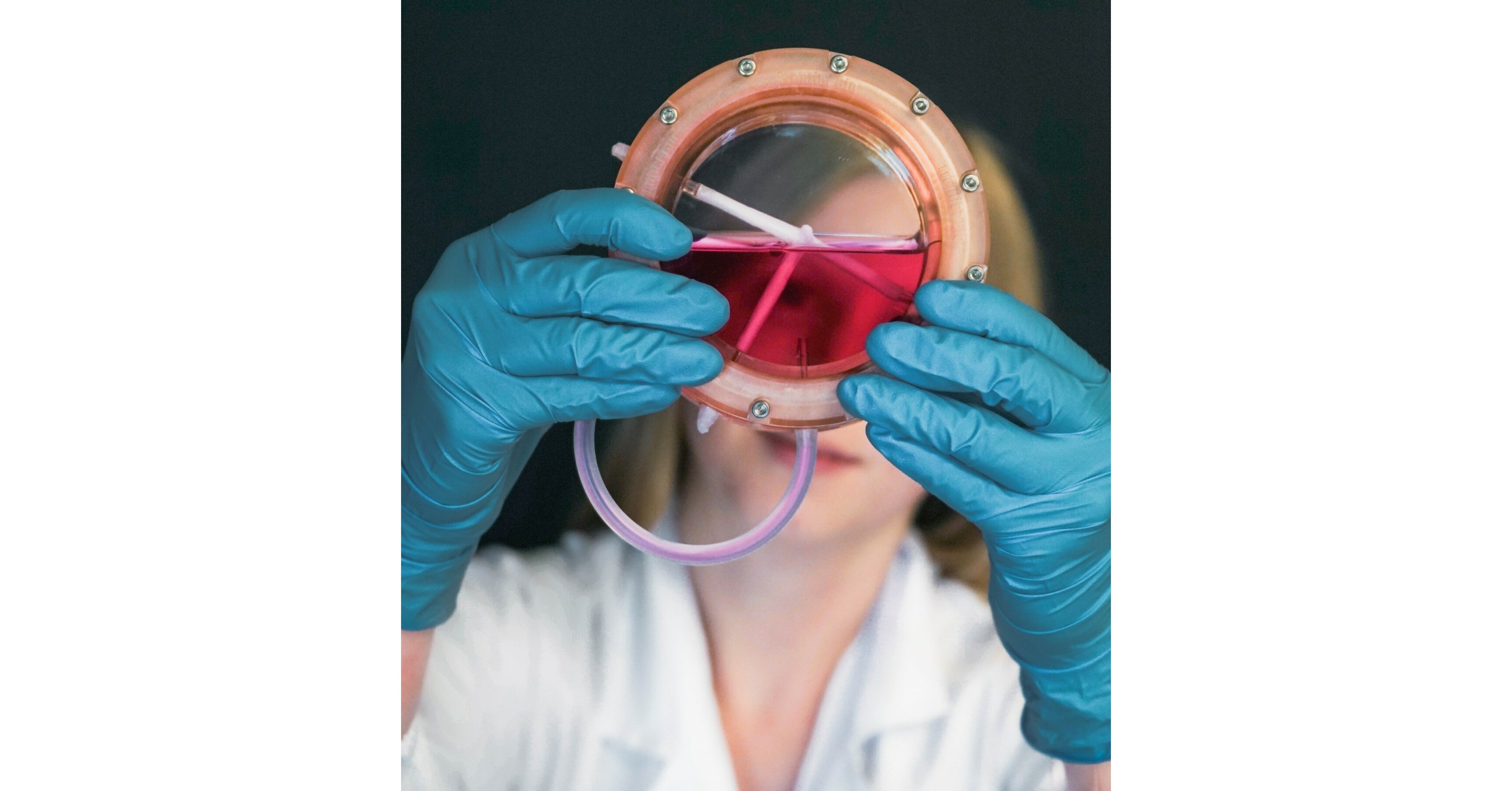 Frontier Bio Leads Medical Innovation with "Lab-Grown" Blood Vessel ...