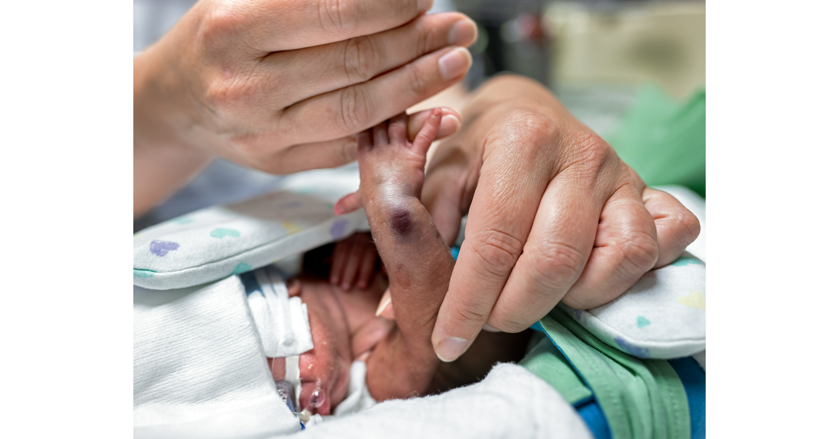 ivWatch Announces "Pain Should Not Be Silenced" Gallery Exhibition to ...