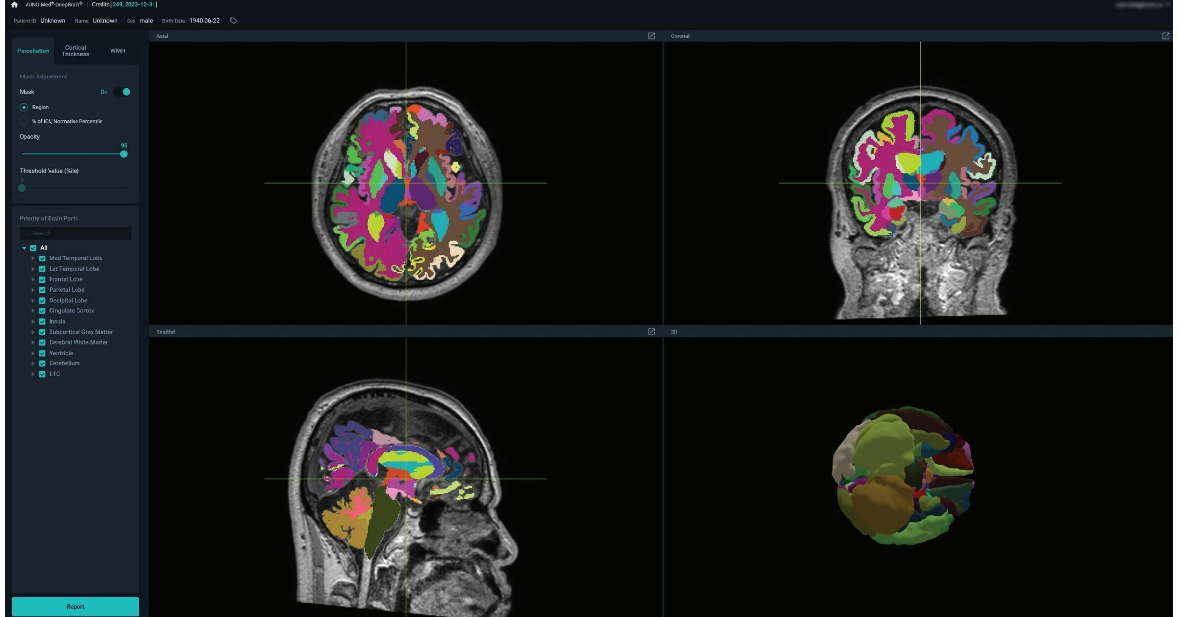 VUNO Secures FDA 510(k) Clearance for VUNO Med®-DeepBrain®
