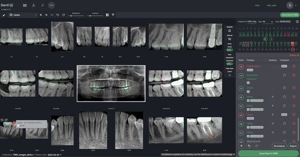 DENTI.AI PIONEERS FDA-CLEARED PATHOLOGY DETECTION IN BOTH PANORAMIC AND INTRAORAL X-RAYS WITH ...