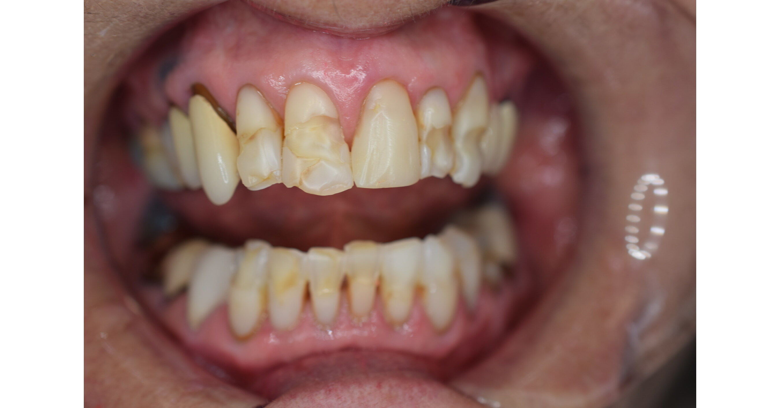 Dental Care for the Golden Years: Oral Health Tips from Dentists for ...