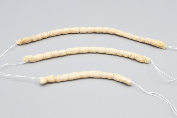 ALLOSOURCE ANNOUNCES FIRST IMPLANT OF ACECONNEX™ PRE-SUTURED FASCIA ...