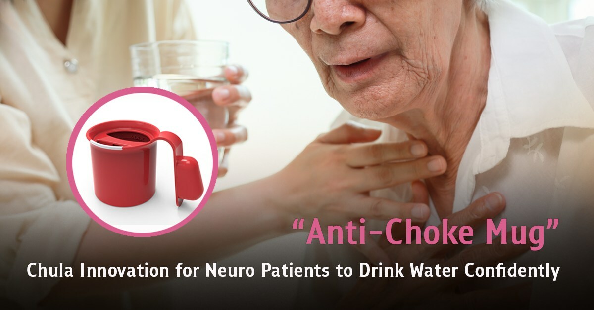 "Anti-Choke Mug" - Chula Innovation for Neuro Patients to Drink Water ...