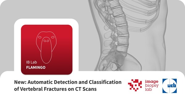 AI Innovation for automated Detection and Classification of osteoporotic Fractures of the Spine ...