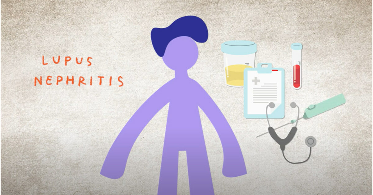 NKF Launches Educational 'Animated Video Series for Patients with Lupus ...