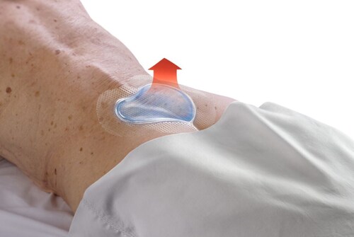 Medline introduces first-of-its-kind transparent wound dressing aiding ...