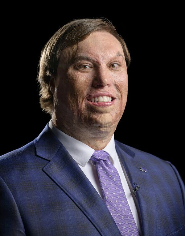 Burn Survivor Connor McKemey to Launch Book Tour at Seacrest Studios in ...