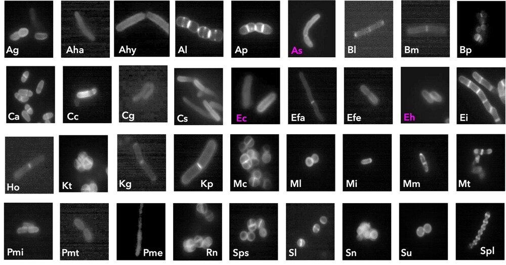 Ancera Unveils New Cutting-Edge Detection Tools to Support Productivity ...