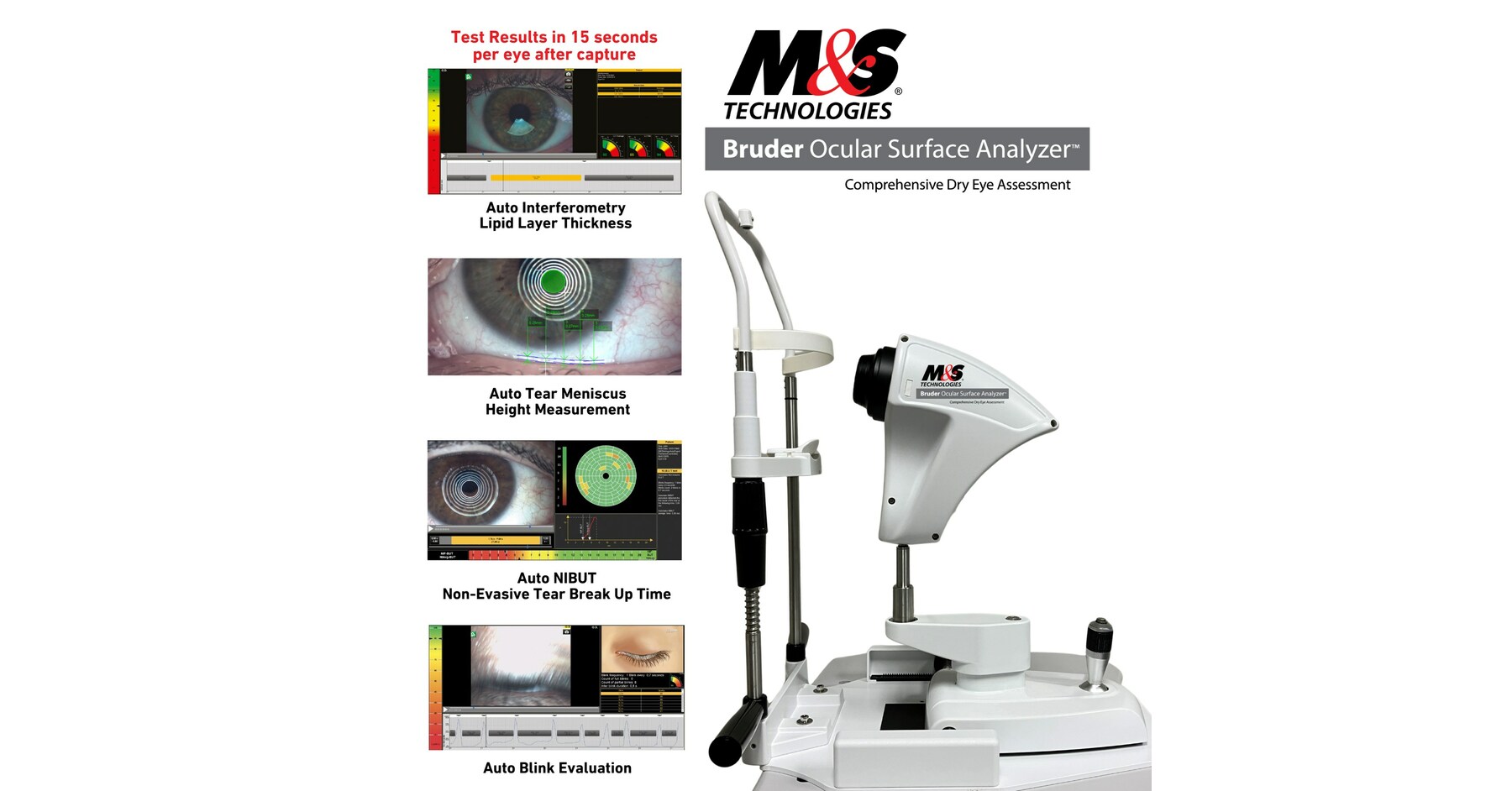 Leading with Clarity: BOSA Equips Eye Doctors for Booming Dry Eye Market