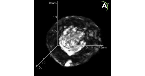 Astrin Biosciences and Leading New York Cancer Center Announce New ...