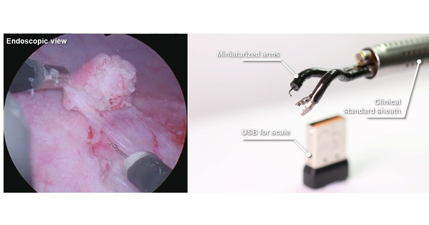 Agilis Robotics Unveils Groundbreaking Advancements in Endoluminal Surgery