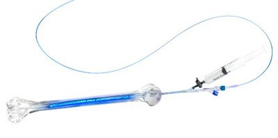 IlluminOss announces their 200th patient in their global device ...