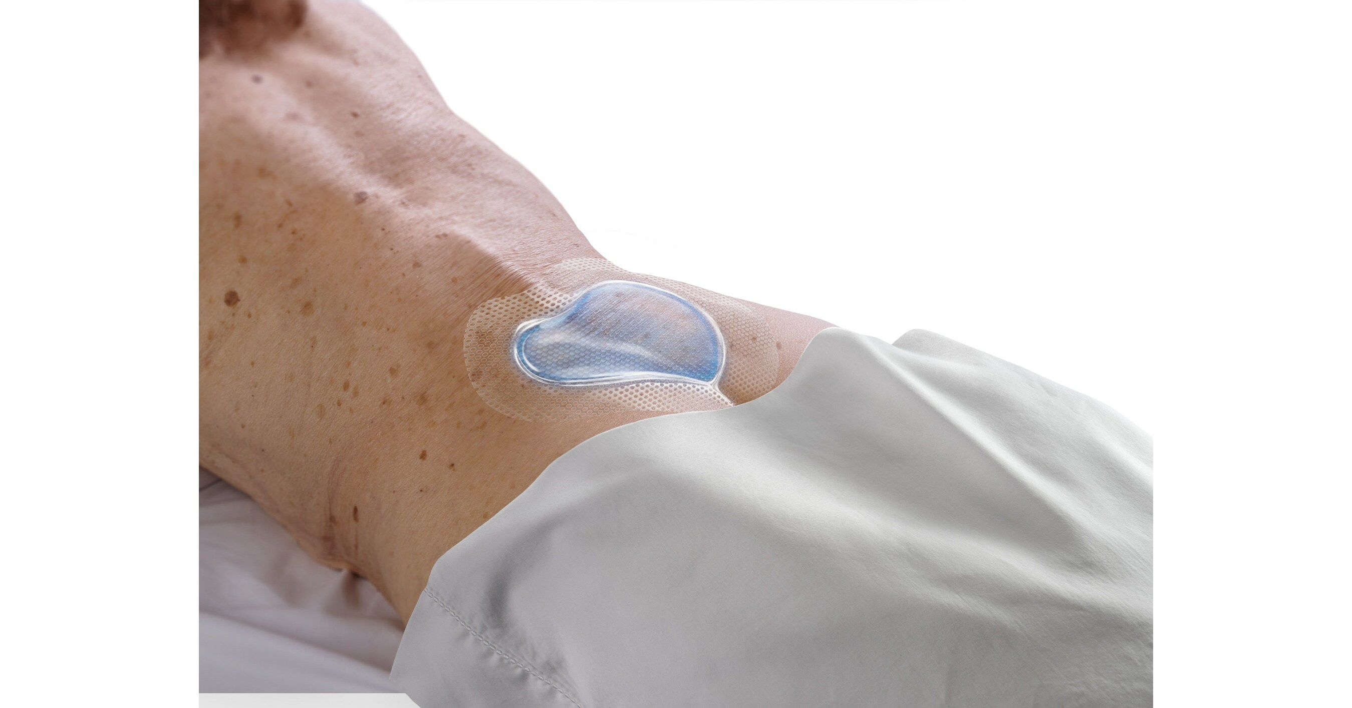 Medline présente la première compresse transparente unique en son genre ...