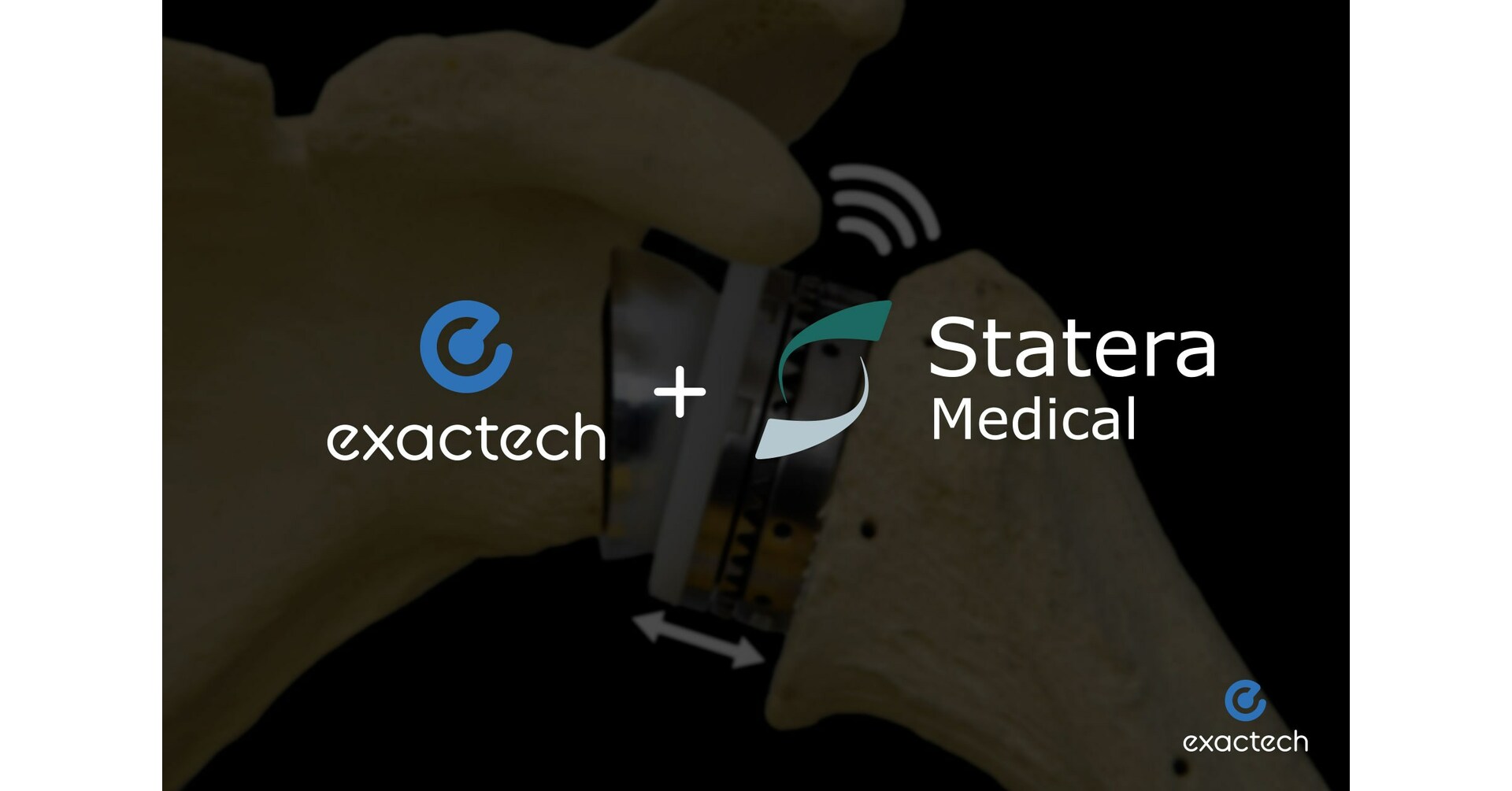 Exactech Partners with Statera Medical to Co-Develop World's First ...