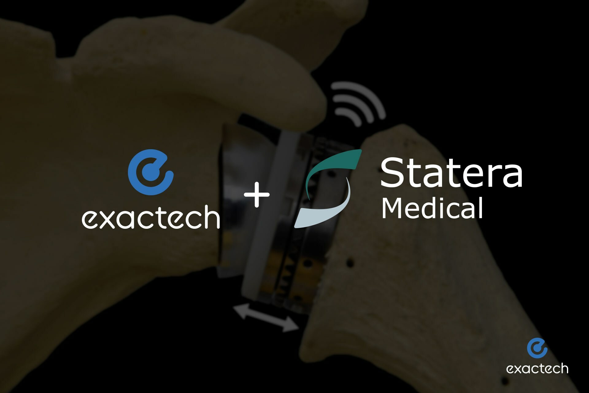 Exactech Partners with Statera Medical to Co-Develop World’s First ...