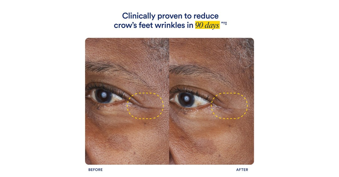 Clinical Trial Proves Ritual's HyaCera Reduces Fine Lines and Wrinkles ...