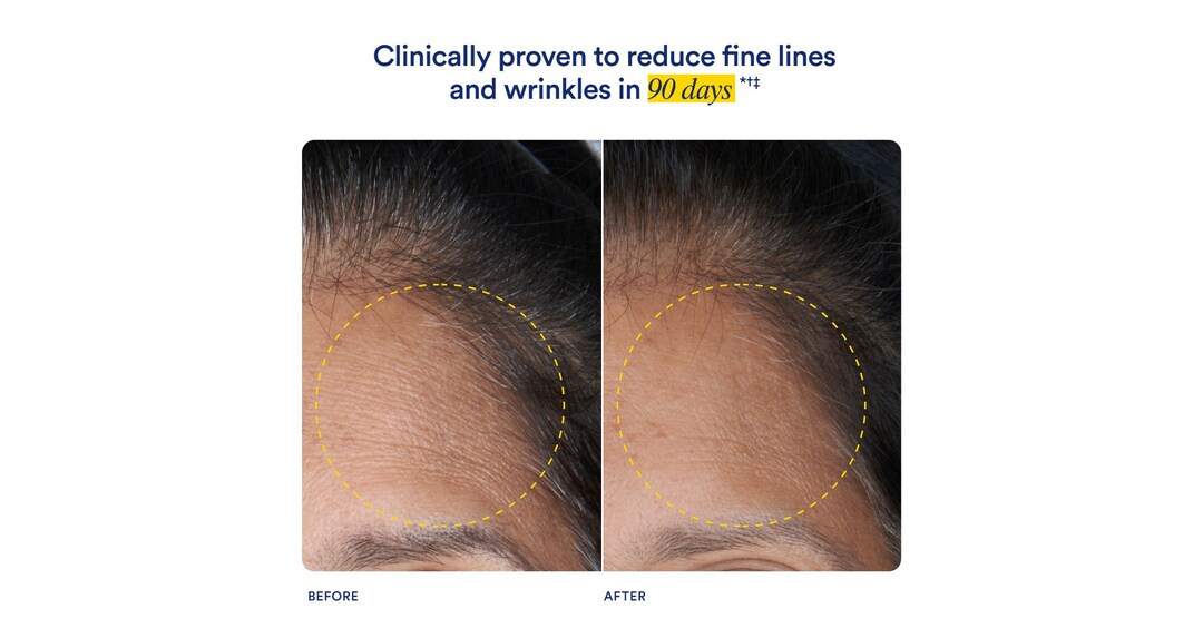 Clinical Trial Proves Ritual's HyaCera Reduces Fine Lines and Wrinkles ...