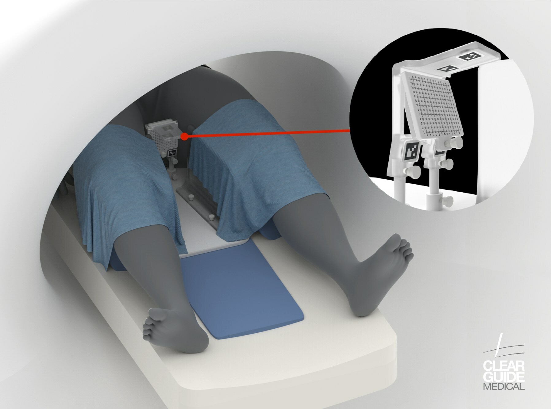 Clear Guide Medical Receives FDA Clearance for CLEAR GUIDE SCENERGY ...