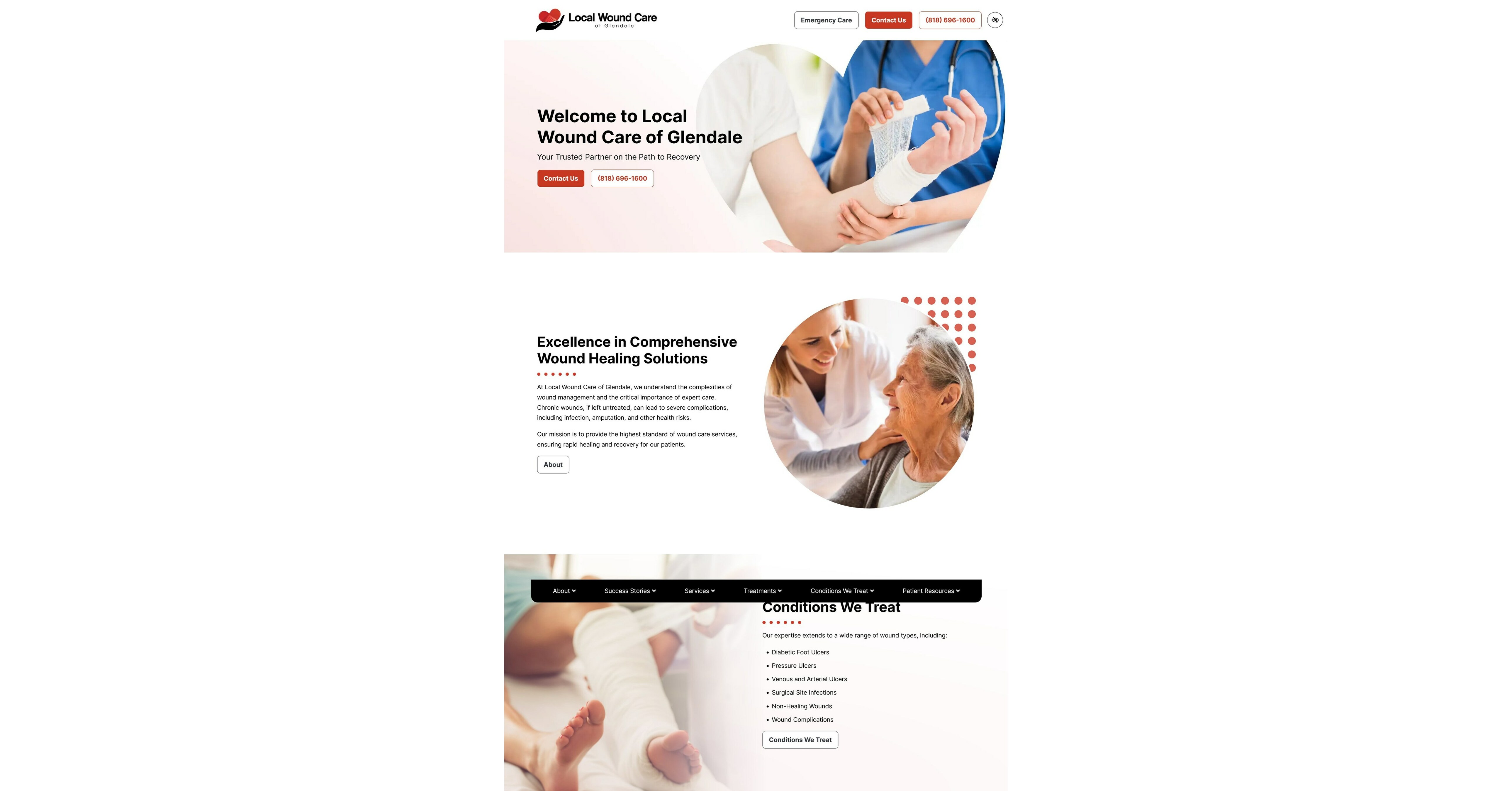 Local Wound Care of Glendale Unveils New Website, Enhancing ...