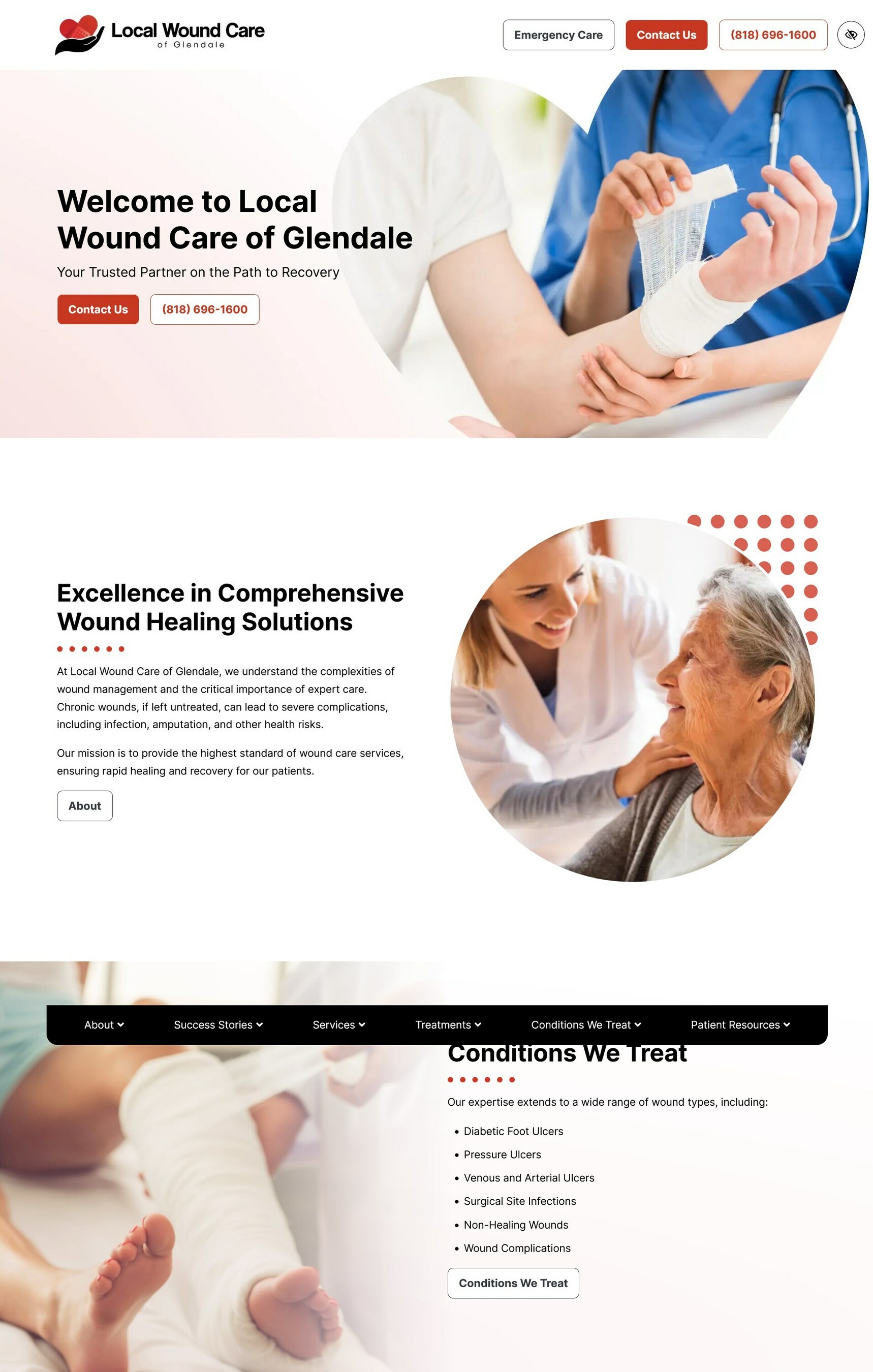 Local Wound Care of Glendale Unveils New Website, Enhancing ...