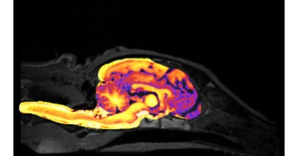 Calyx and Invicro agree to combine to create a global leader in medical ...