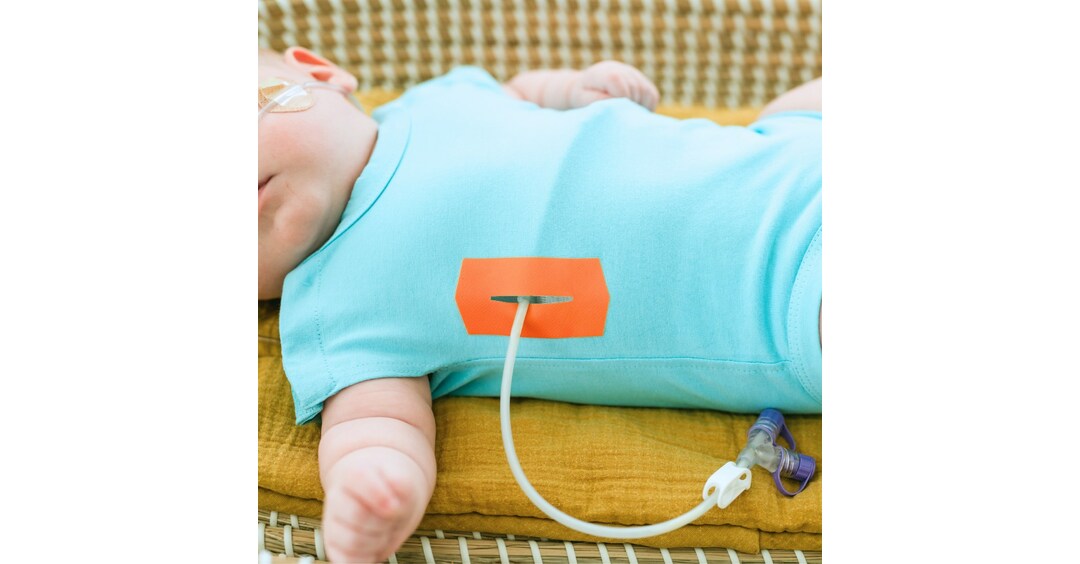 Tube-eeze Patches Revolutionize Accessibility for Babies with Medical Equipment