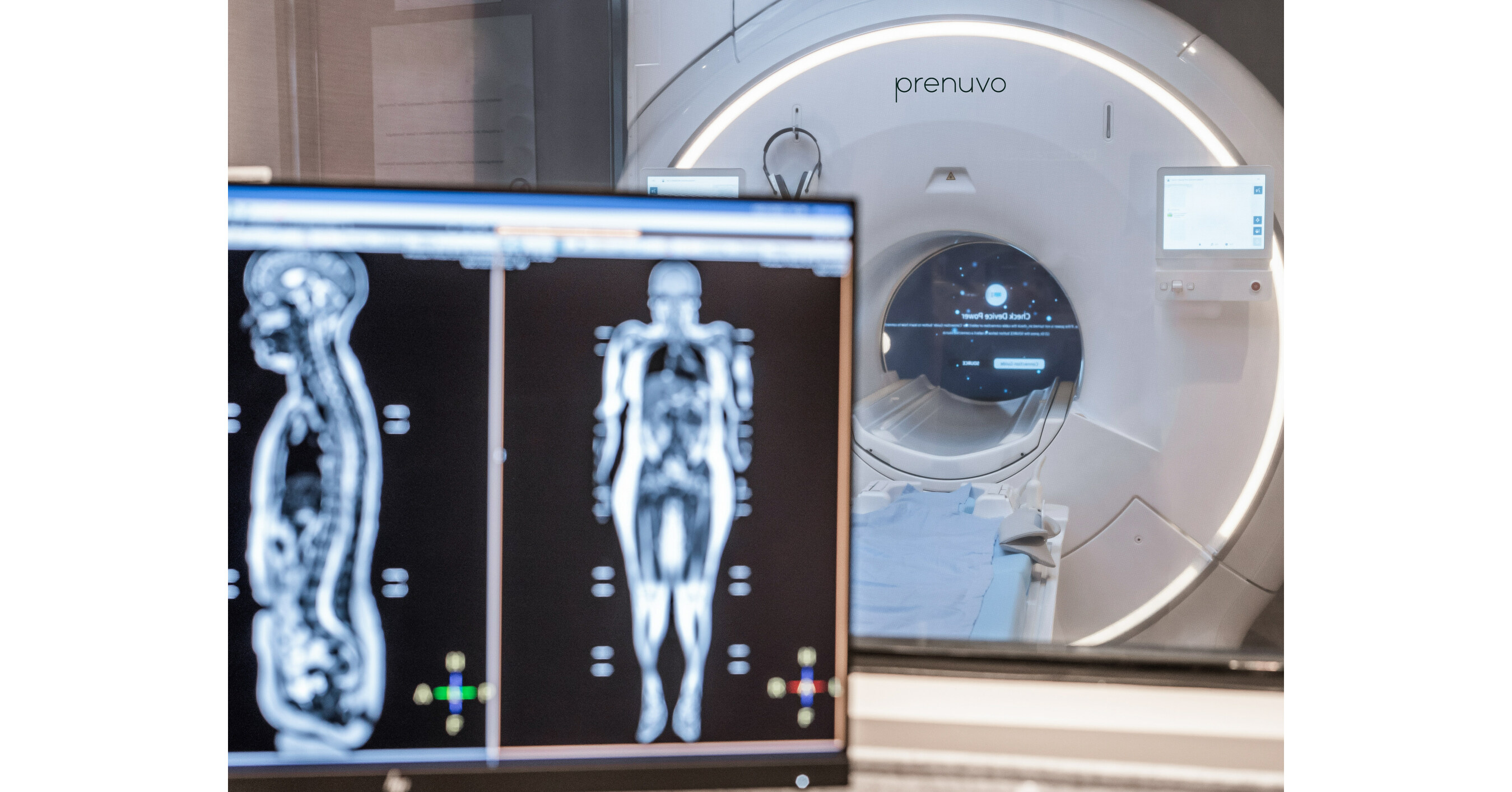 Sollis Health Partners with Prenuvo to Introduce a Groundbreaking ...