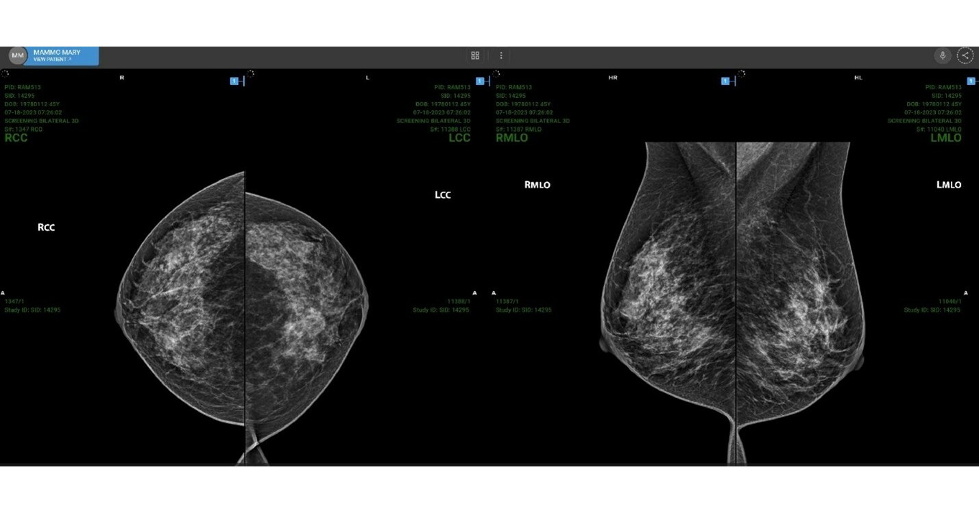 "Progressive Loading" launched on RamSoft's OmegaAI™ Cloud-Native ...