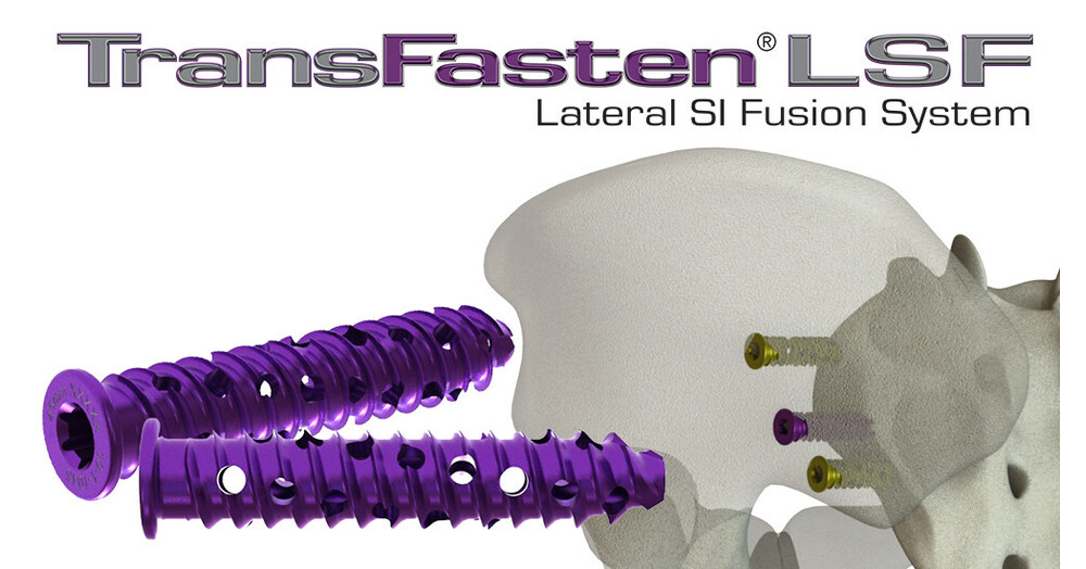 Captiva Spine Introduces TransFasten® LSF, Lateral SI Fusion System ...