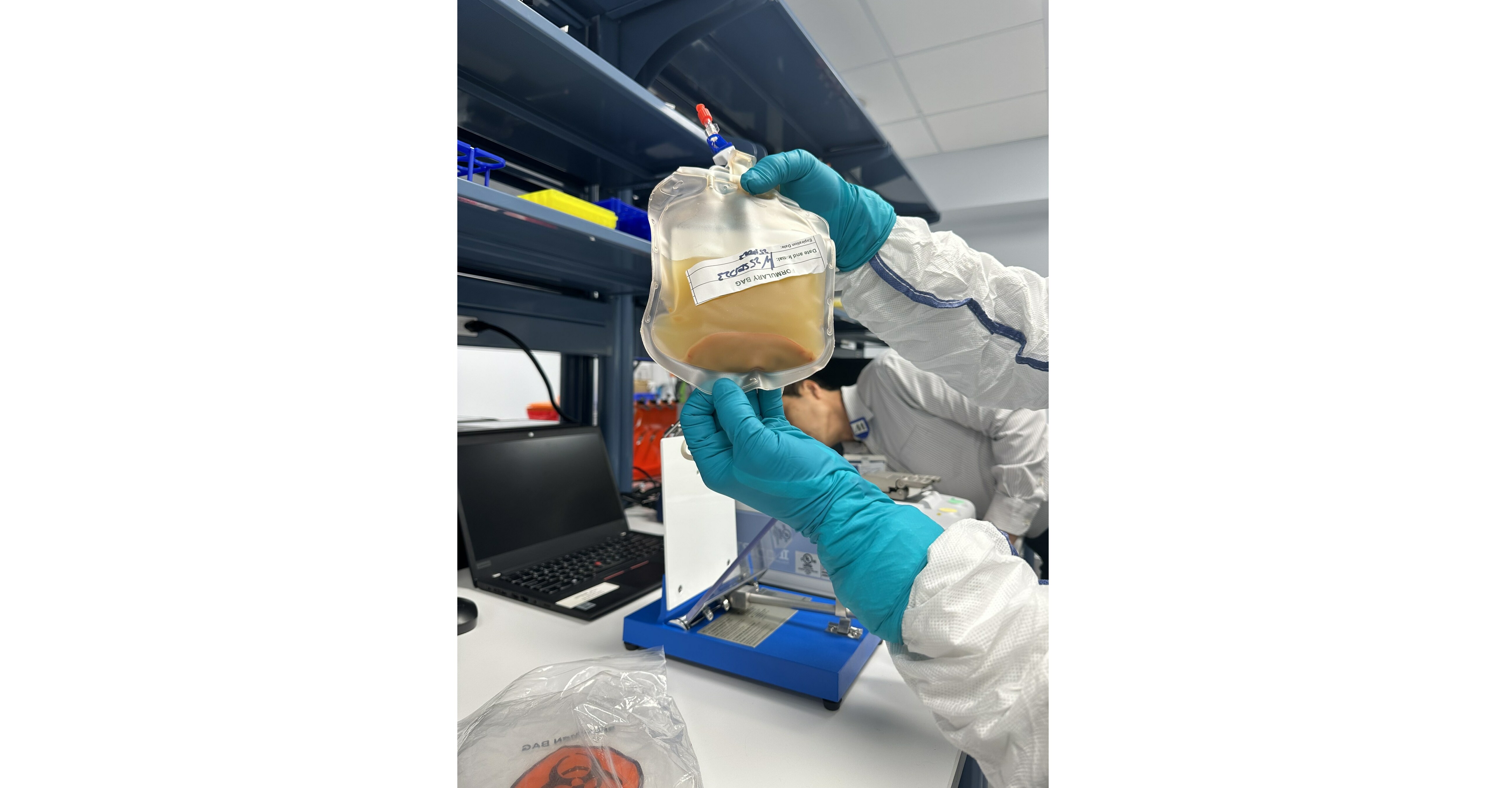 LyGenesis Announces First Patient Dosed in its Phase 2a Clinical Trial ...