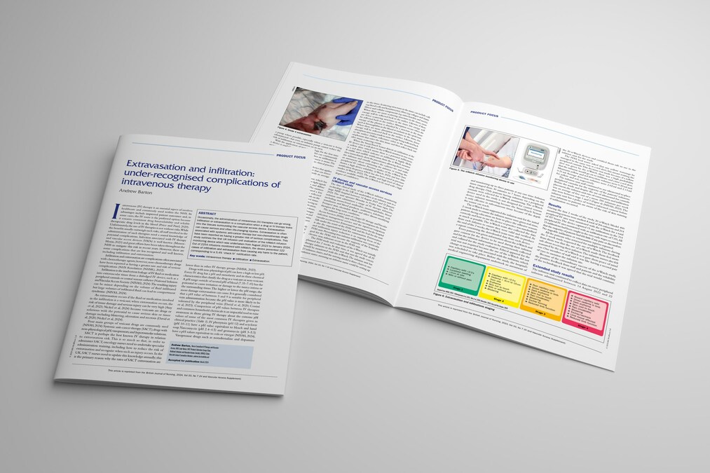 Iv Complications Extravasation