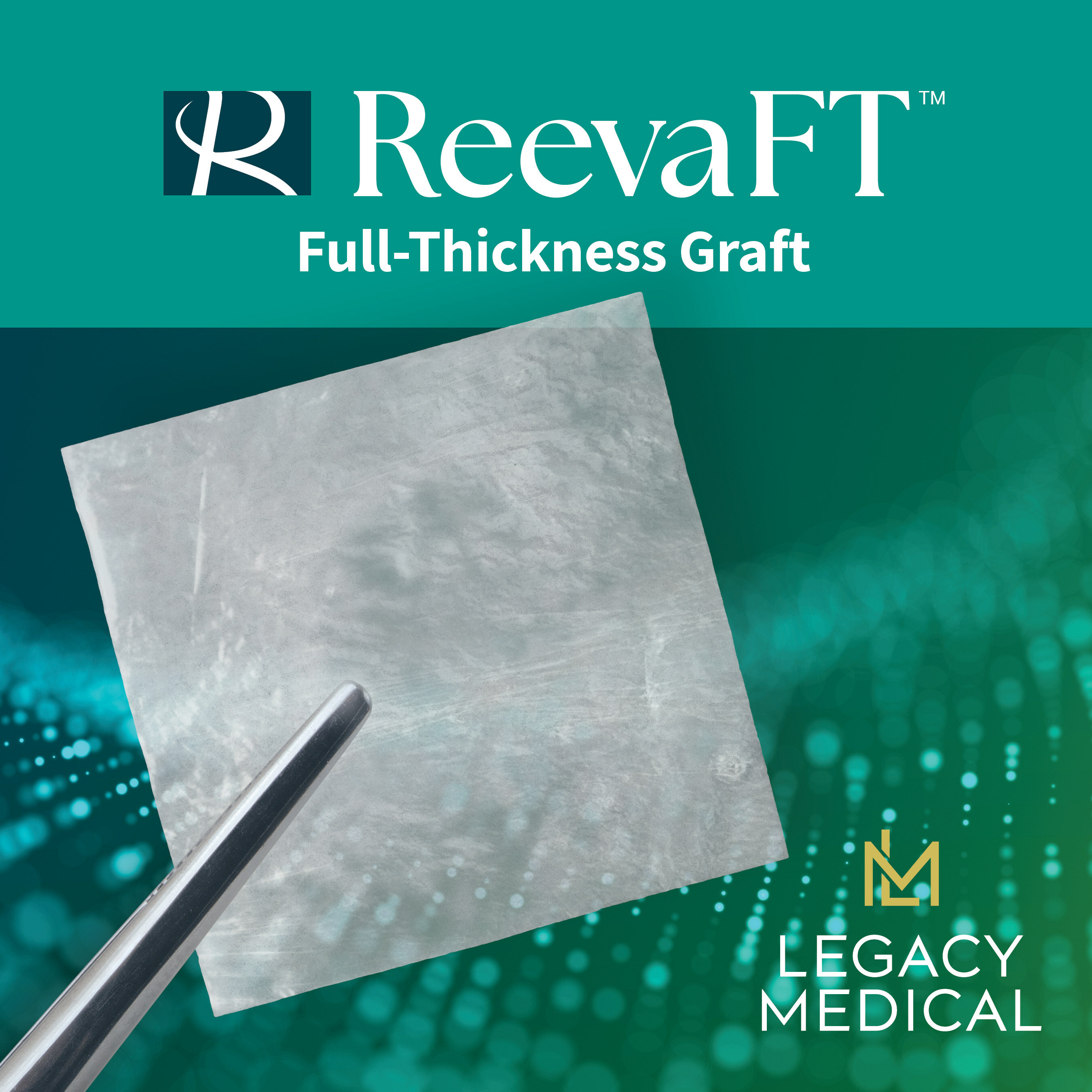 Legacy Medical Consultants Announces Reeva FT™, a Full-Thickness ...