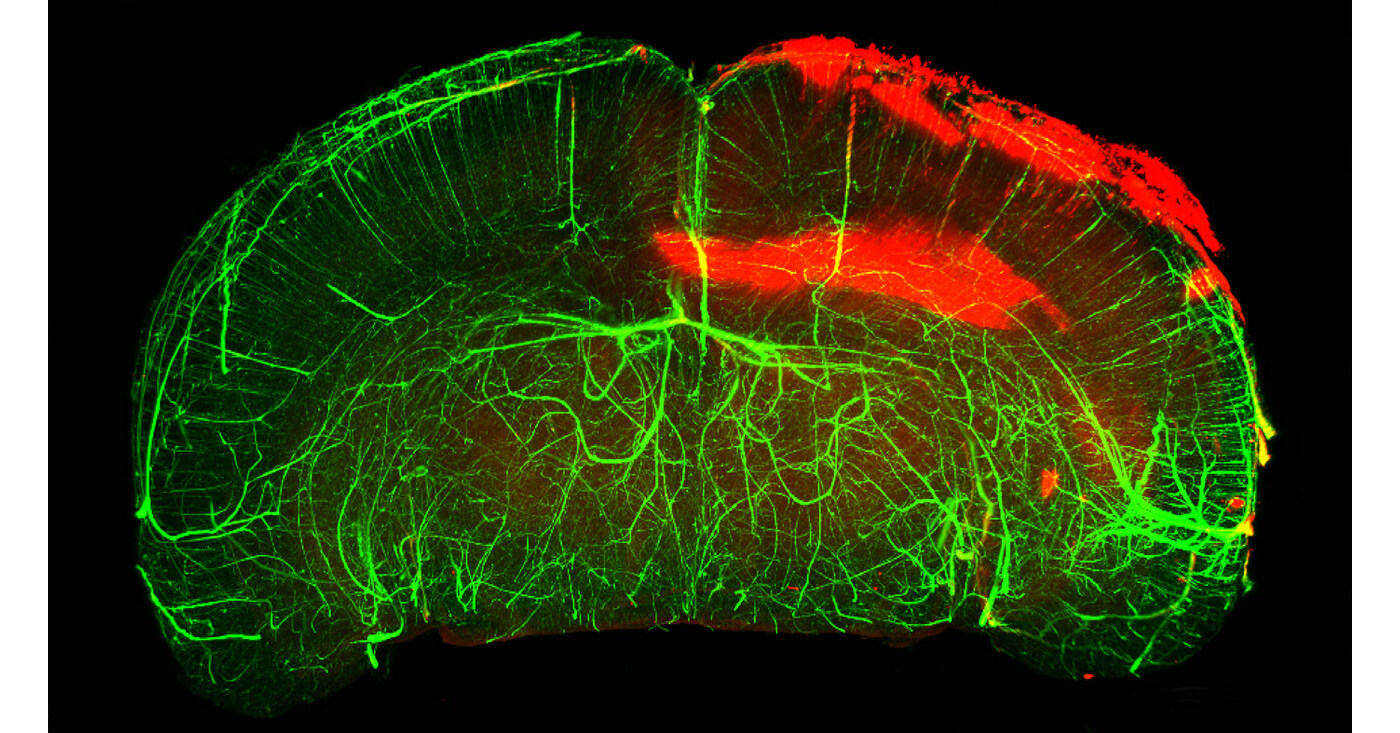 A New Therapeutic Target for Traumatic Brain Injury