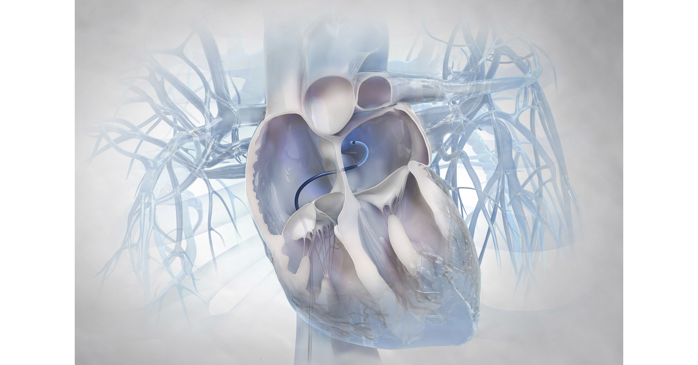 CIRCA SCIENTIFIC to Attend Heart Rhythm 2024