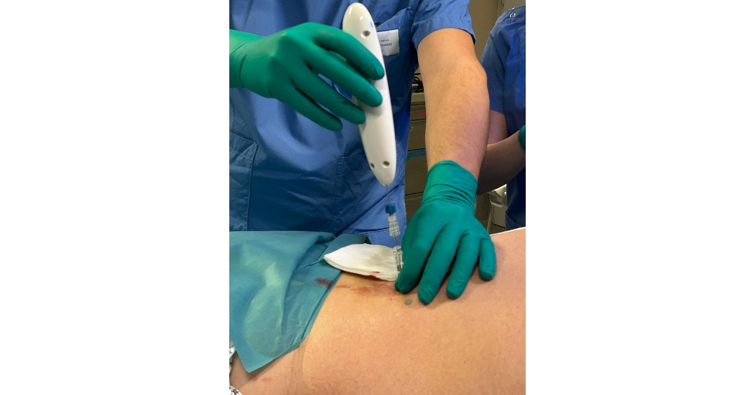 Single Pass, Inc. Announces FDA Clearance of its Kronos Biopsy Closure ...