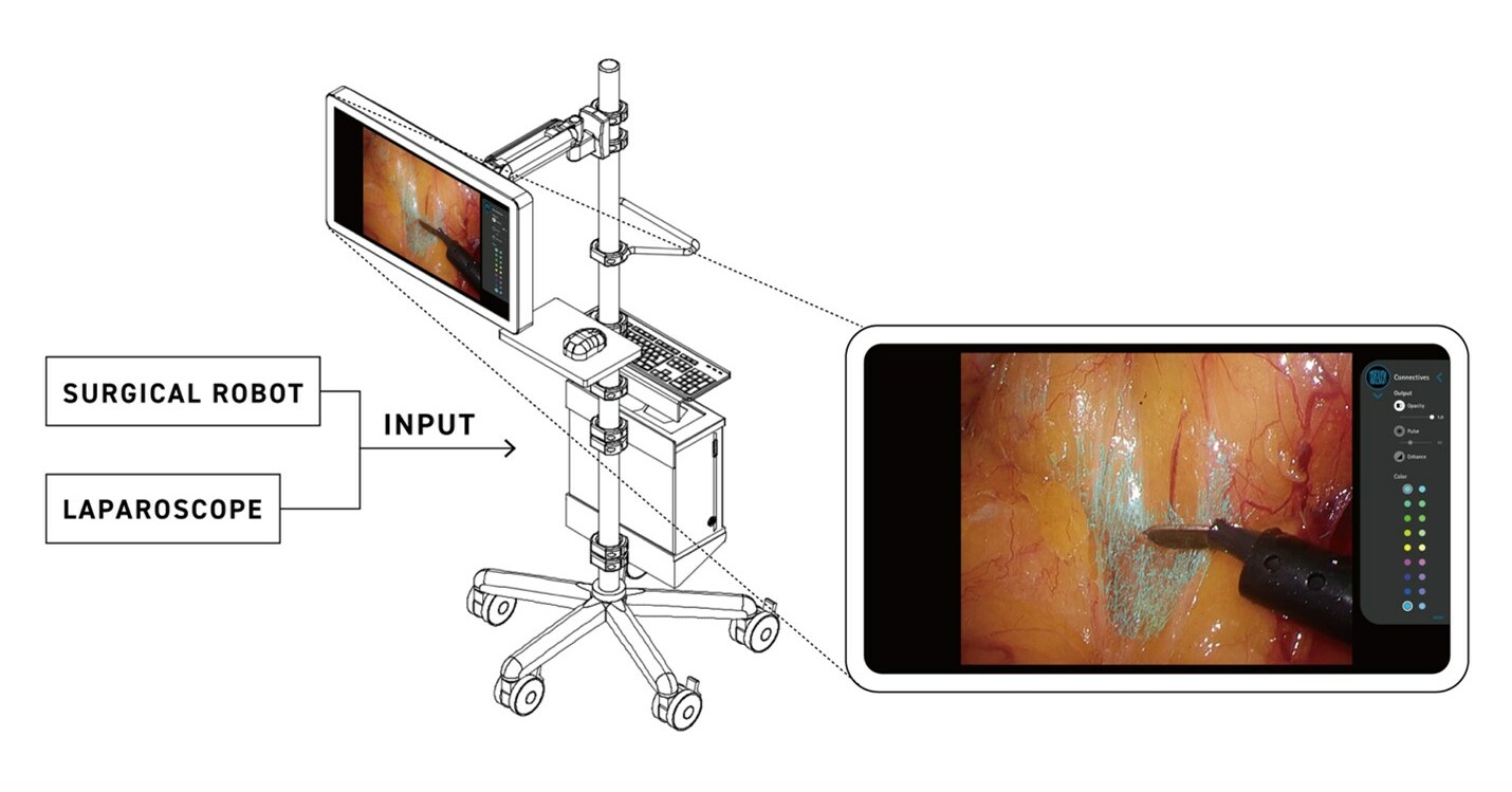 Anaut Announces Japanese Regulatory Approval of AI-Powered Surgical ...
