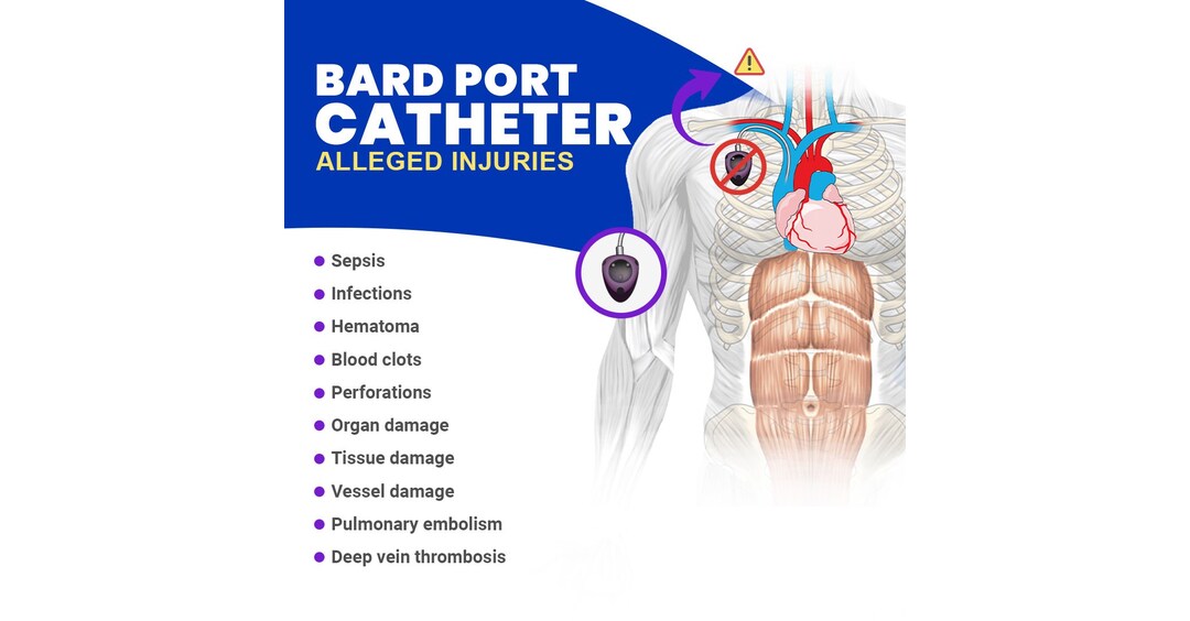 Advocate Rights Center Launches Guide for Bard PowerPort Leads ...