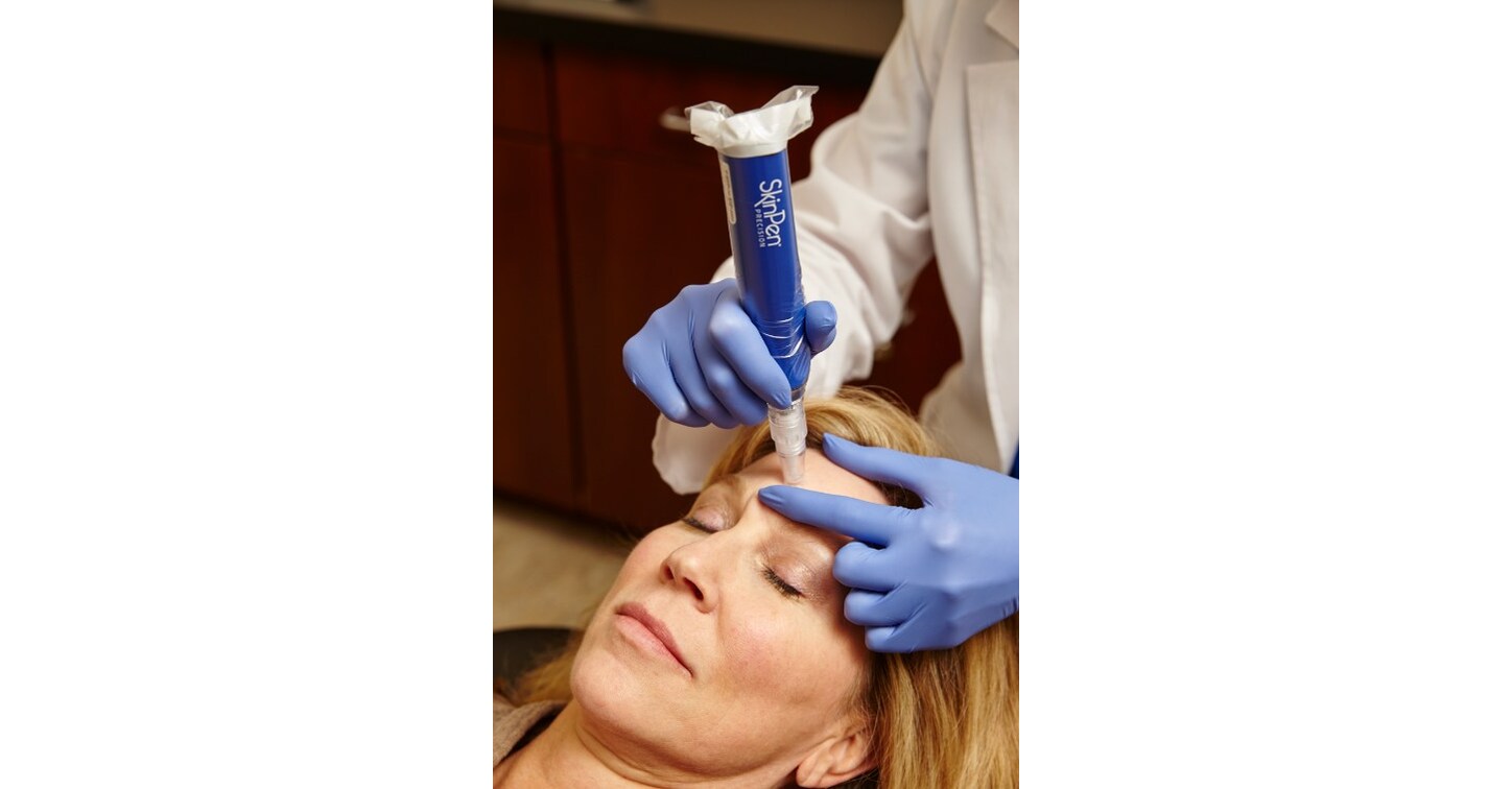 Regen Wellness Announces Microneedling as a More Natural Skin Treatment