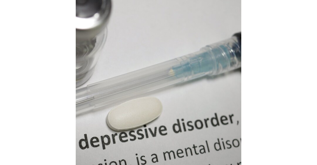 Revolutionizing Depression Treatment: TMS Therapy Offers Hope for Major ...