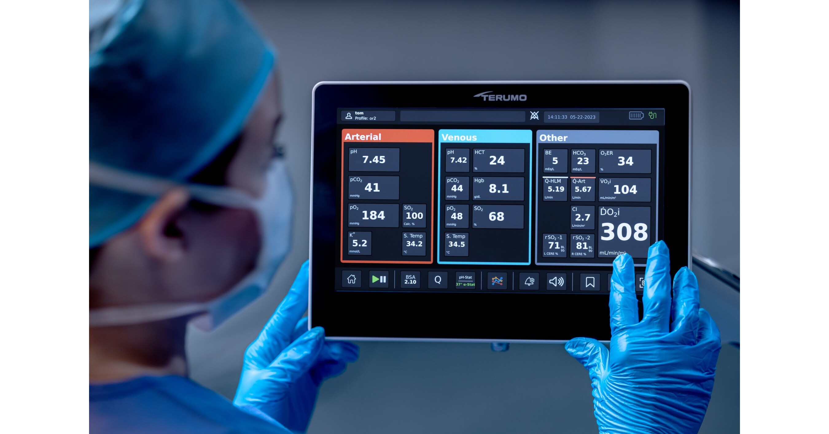 Terumo Cardiovascular Announces 510(K) Clearance for the CDI OneView ...