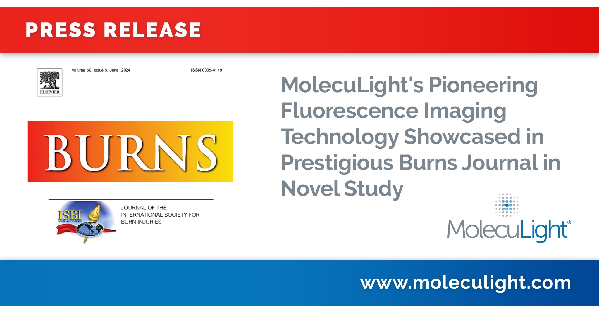 MolecuLight's Pioneering Fluorescence Imaging Technology Showcased in Prestigious Burns Journal ...