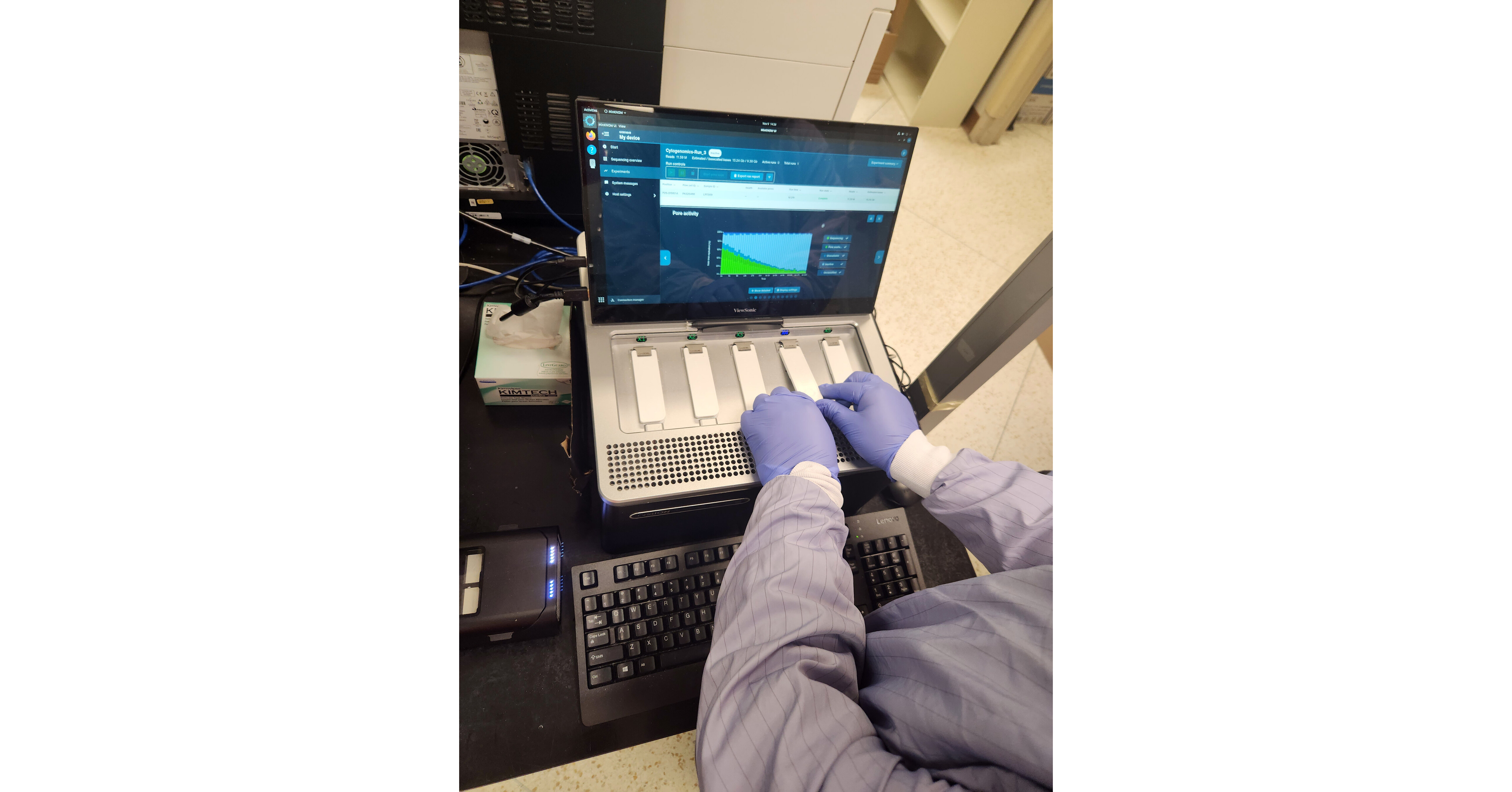 Precision matching for kidney transplants: BC project targets reduced ...