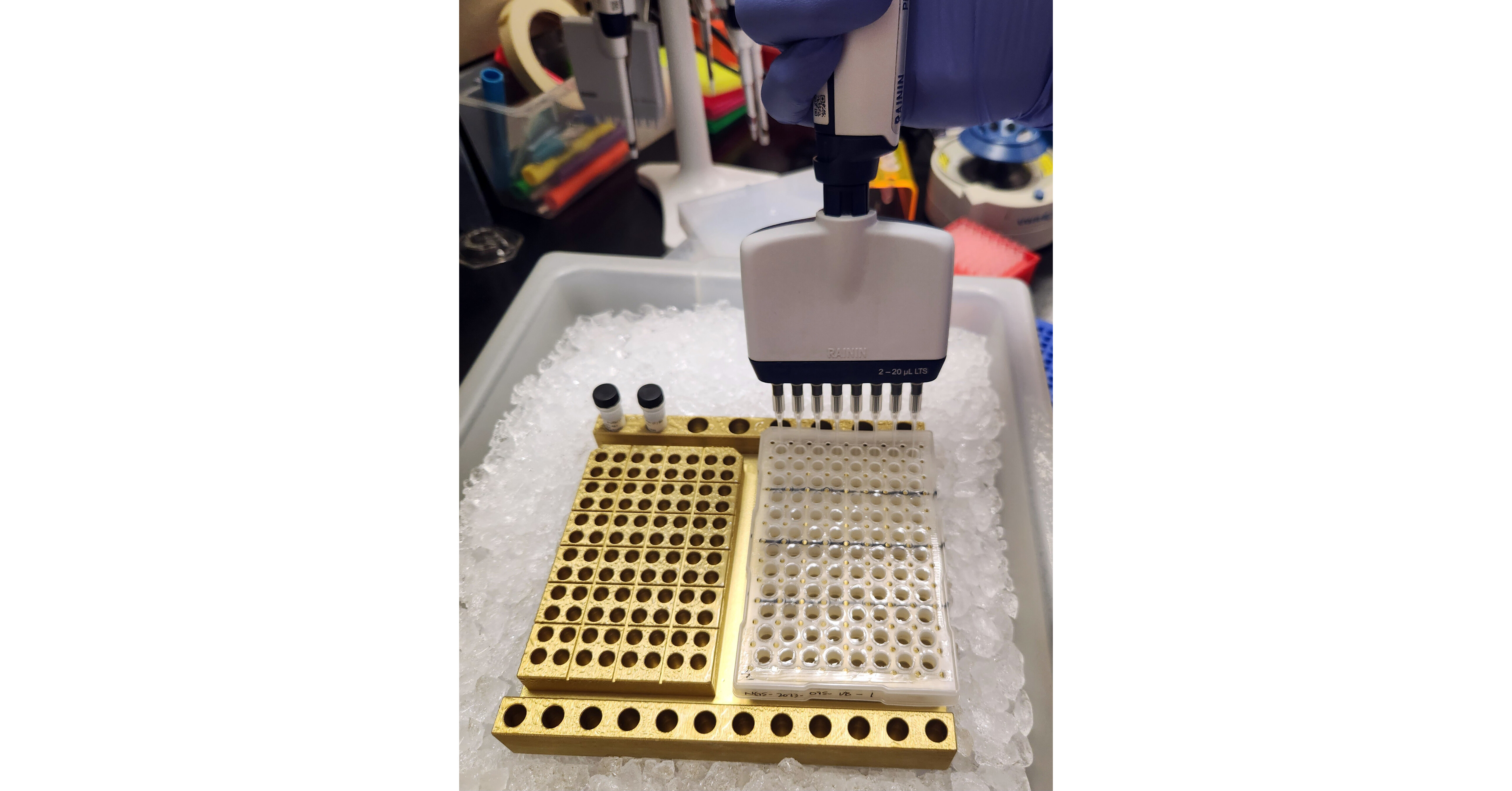 Precision matching for kidney transplants: BC project targets reduced ...