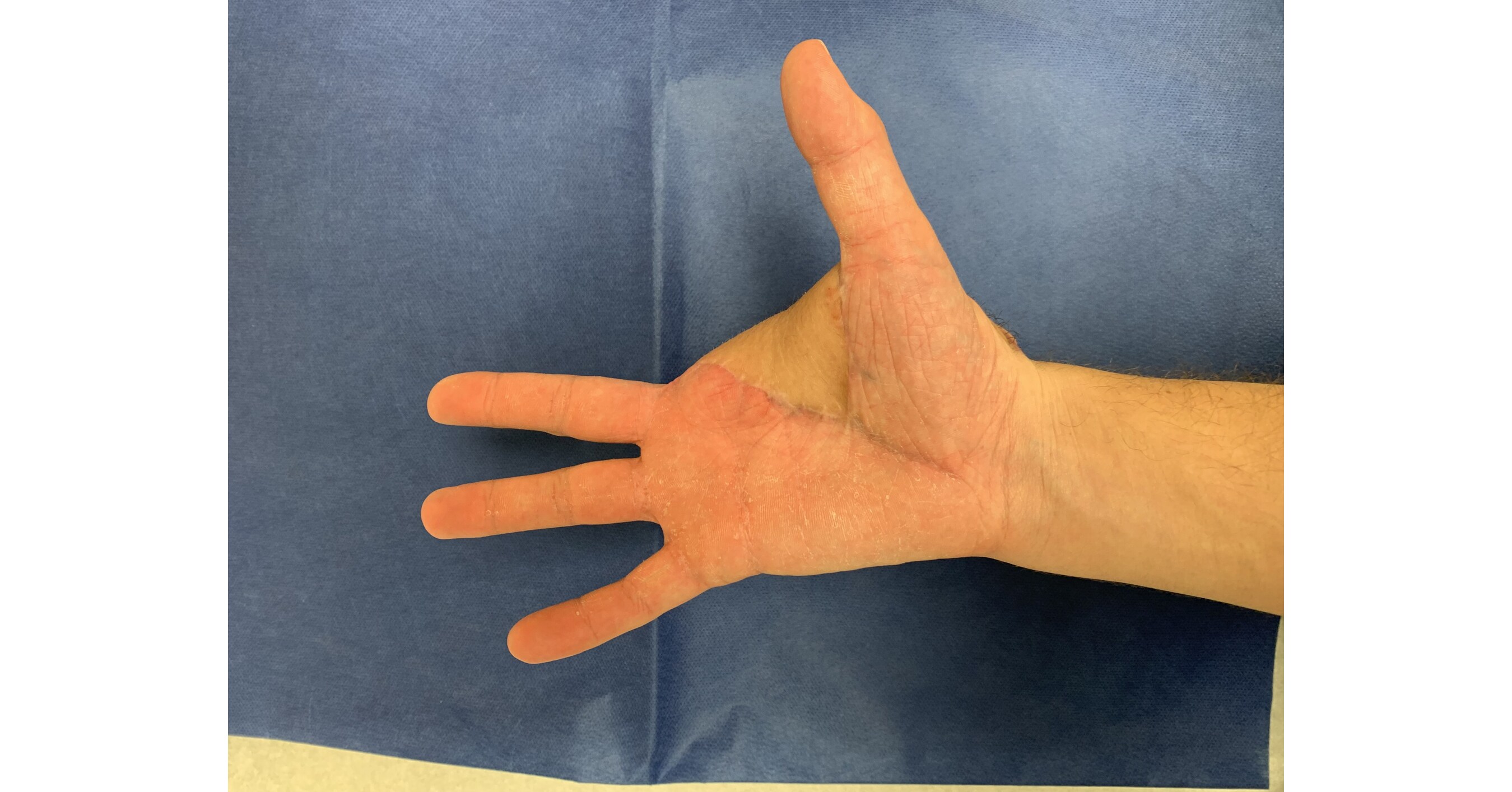 MEDSTAR HEALTH PREPARES FOR FIREWORKS SEASON WITH SAFETY TIPS AND WARNING