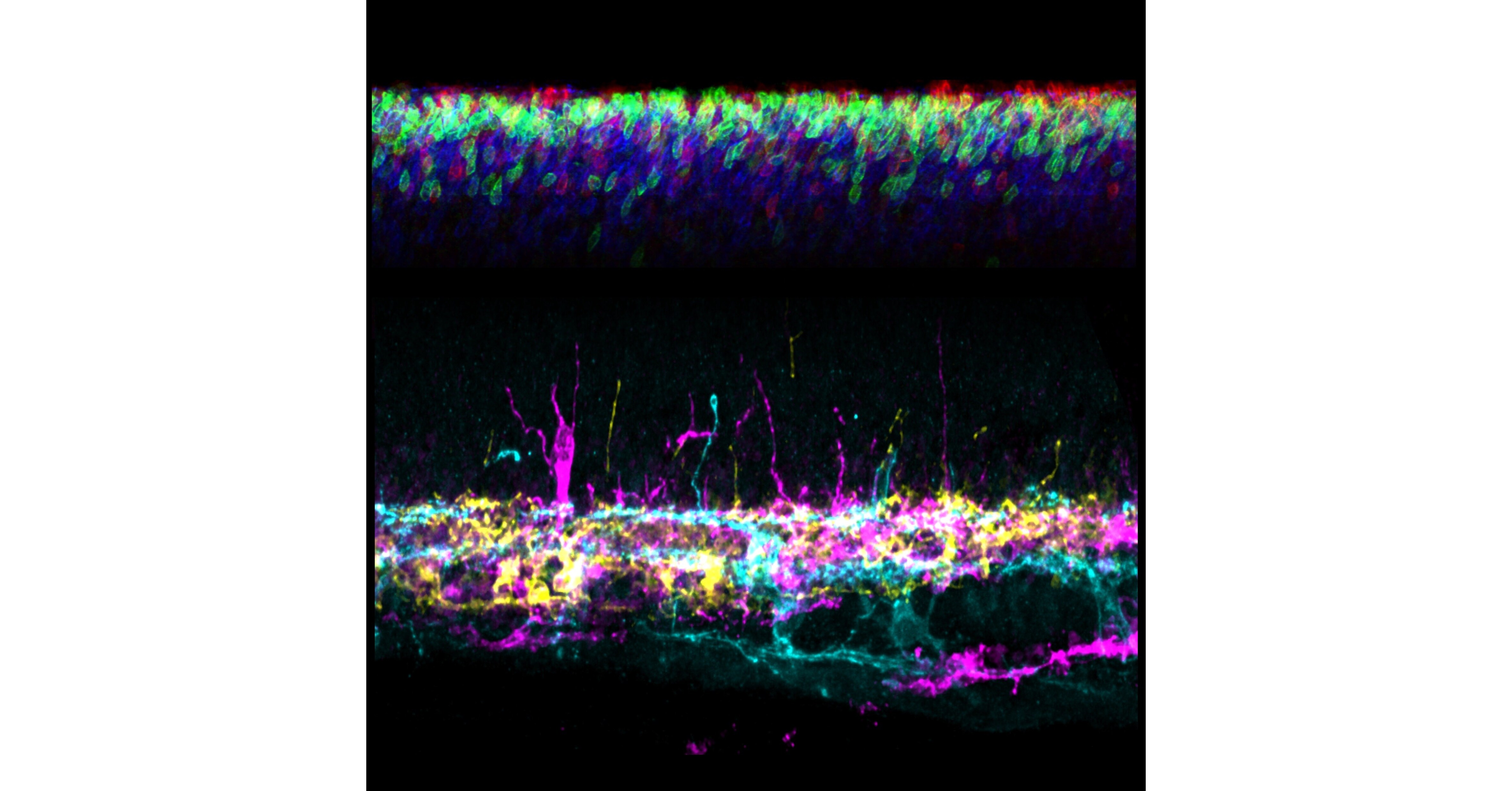 Improved Light Control Might Help Prevent Eye Problems in Premature Infants