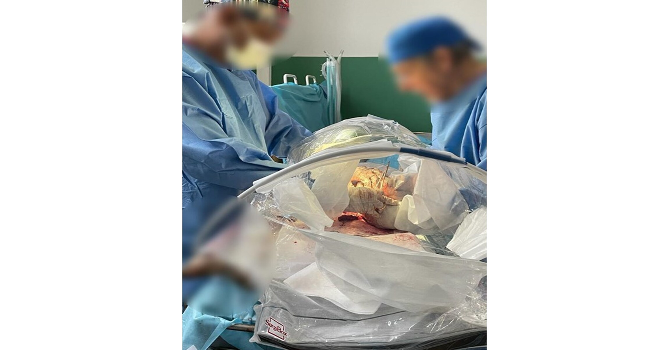 MHSRS 2024: SurgiField systems reported by mobilized surgeons in ...