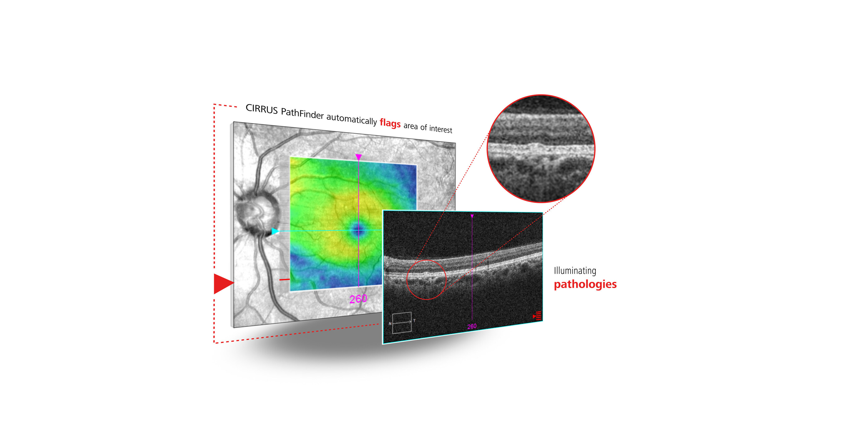 ZEISS innovation paves way to more personalized patient care with ...