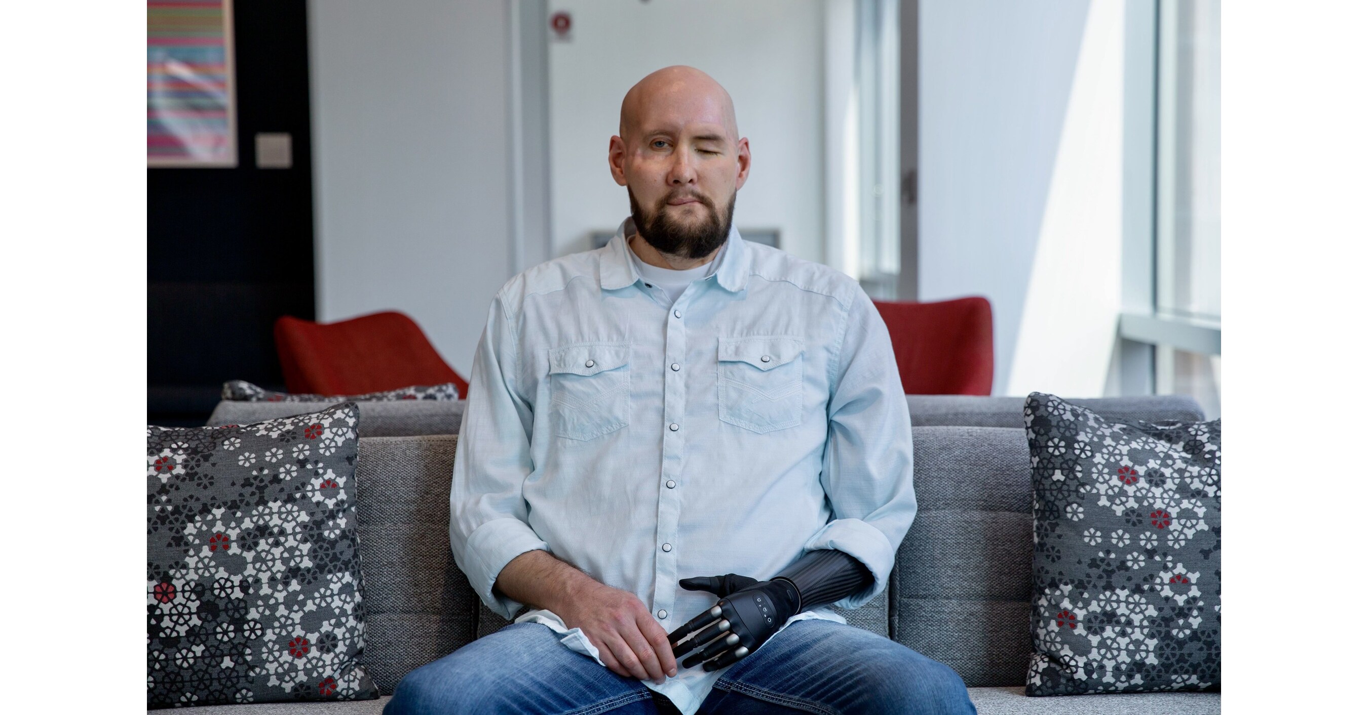 The World's First Whole-Eye & Partial-Face Transplant Recipient ...