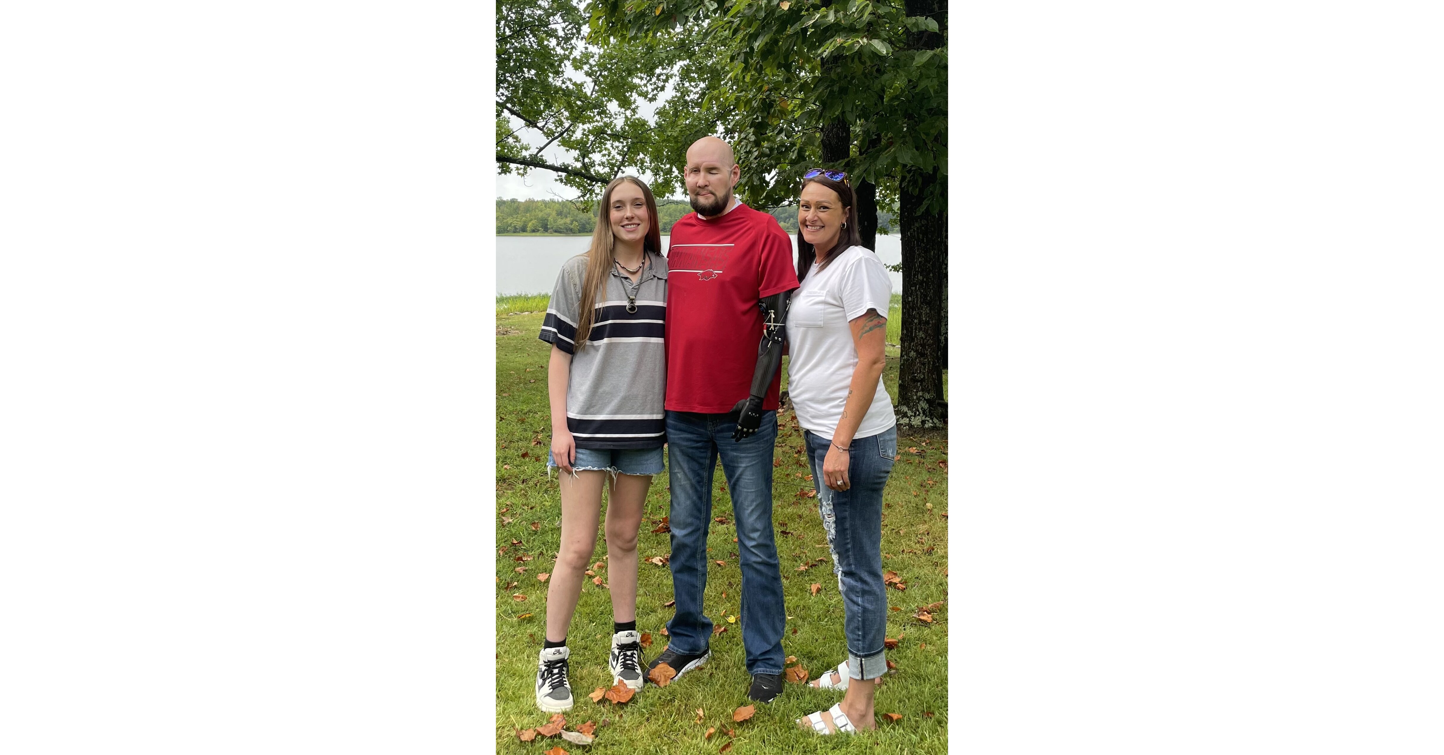 The World's First Whole-Eye & Partial-Face Transplant Recipient ...